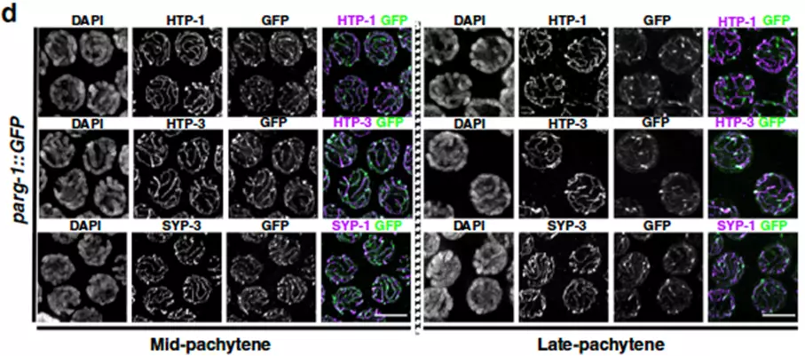 Nové poznatky o zlomech DNA a jejich opravě